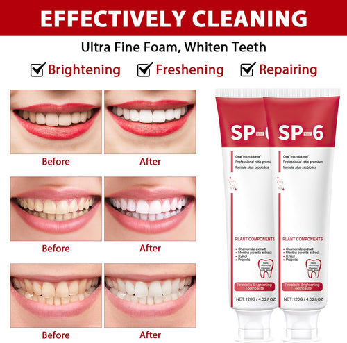 SP-6 Toothpaste Ultra Whitening – SV CHRONO